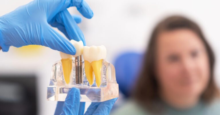 What Are Fake Teeth Called? – Dr Kaplansky